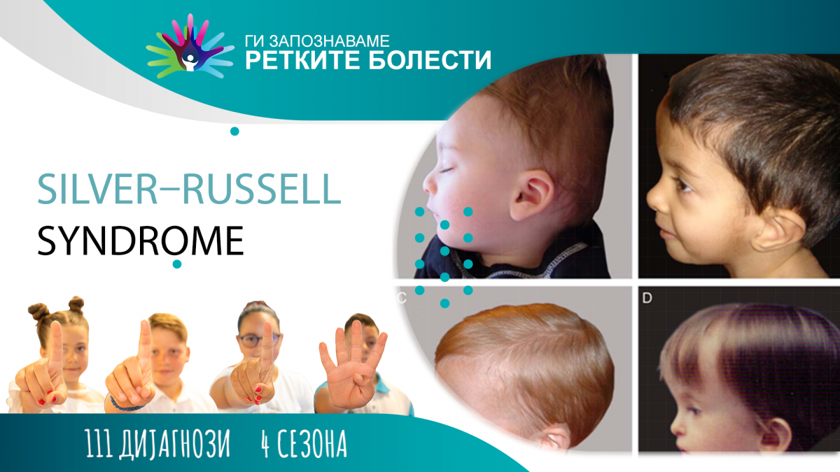ГИ ЗАПОЗНАВАМЕ РЕТКИТЕ БОЛЕСТИ: СИЛВЕР-РАСЕЛОВ СИНДРОМ - Сакам Да Кажам